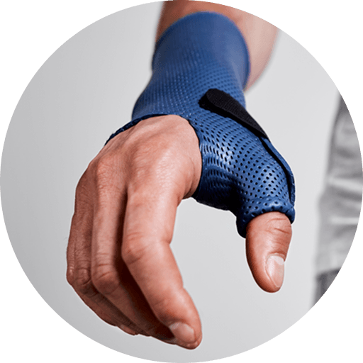 Thermoplastic Solutions for Hand Therapy and Face Protection